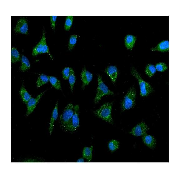 Anti-IL2 Receptor beta/p75/IL2RB Antibody Picoband™| Bosterbio