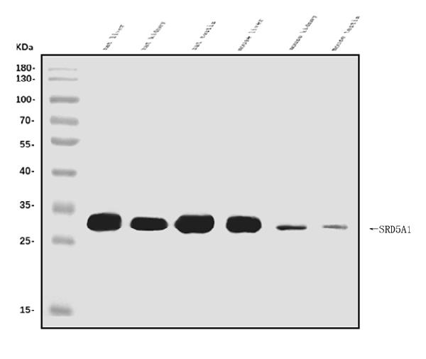 Anti-SRD5A1 Antibody Picoband™| Bosterbio