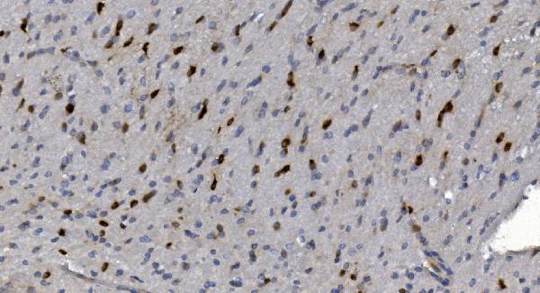 Alpha B Crystallin/CRYAB Antibody