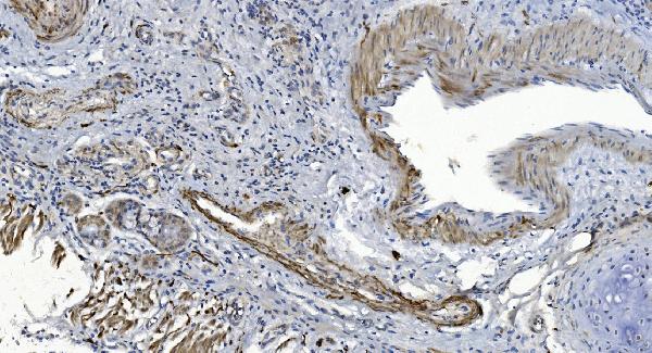Alpha B Crystallin/CRYAB Antibody