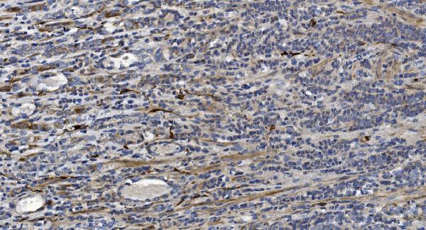 Alpha B Crystallin/CRYAB Antibody