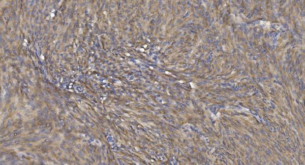 Alpha B Crystallin/CRYAB Antibody