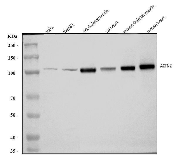 Anti-ACTN2 Antibody Picoband™| Bosterbio
