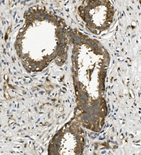 Anti-Arp2/ACTR2 Antibody Picoband™| Bosterbio