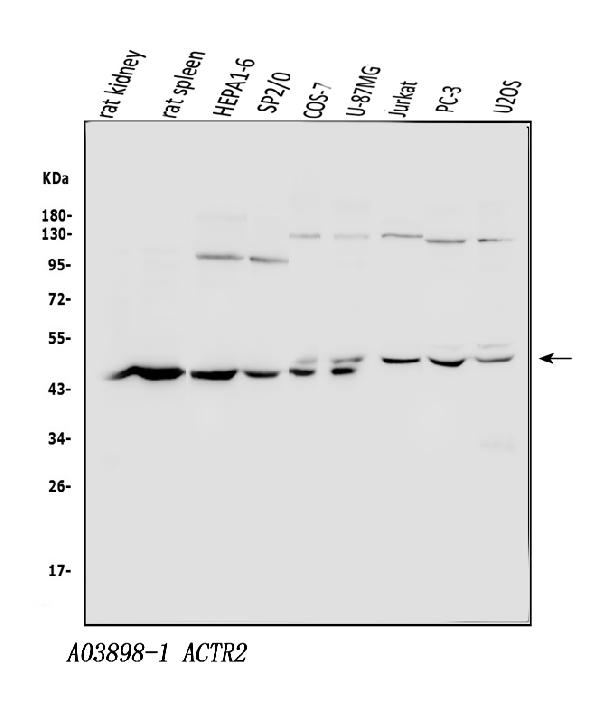 Anti-Arp2/ACTR2 Antibody Picoband™| Bosterbio