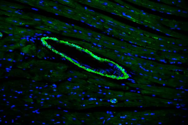 TAGLN/Transgelin Antibody