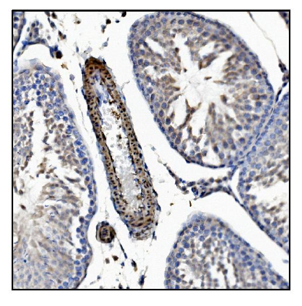 TAGLN/Transgelin Antibody