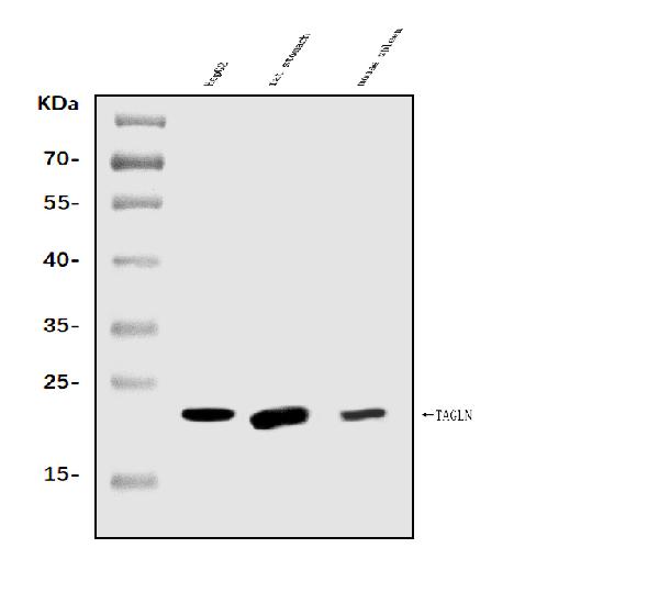 TAGLN/Transgelin Antibody
