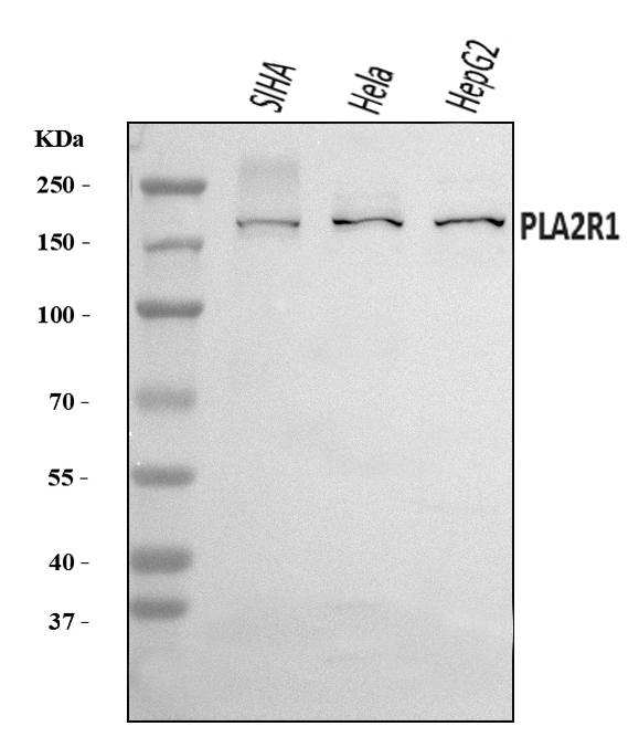 PLA2R/PLA2R1 Antibody