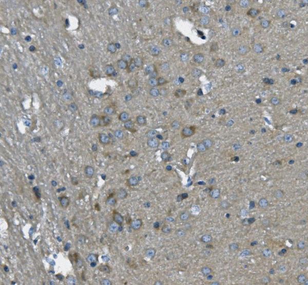 Anti-SCG10/STMN2 Antibody Picoband™| Bosterbio