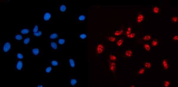AKAP 95/AKAP8 Antibody