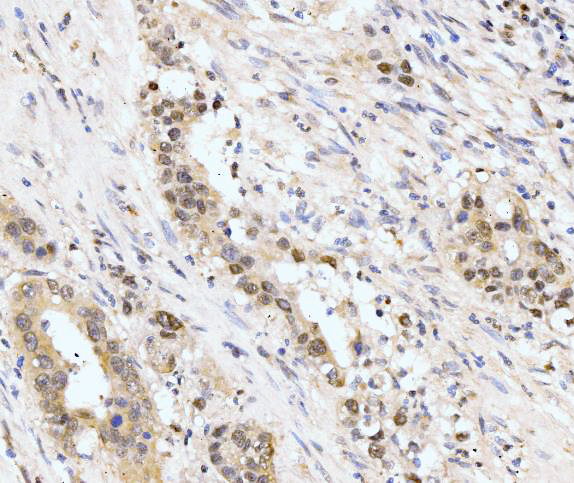 AKAP 95/AKAP8 Antibody