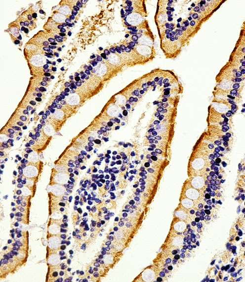 Anti-Alkaline Phosphatase (ALPI) Antibody (Center) | Boster