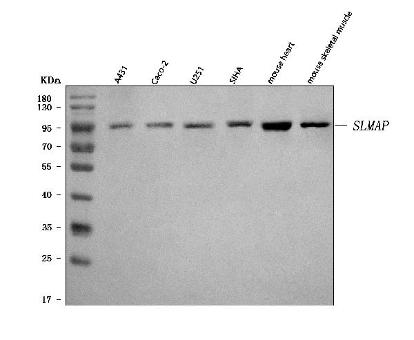 SLMAP Antibody