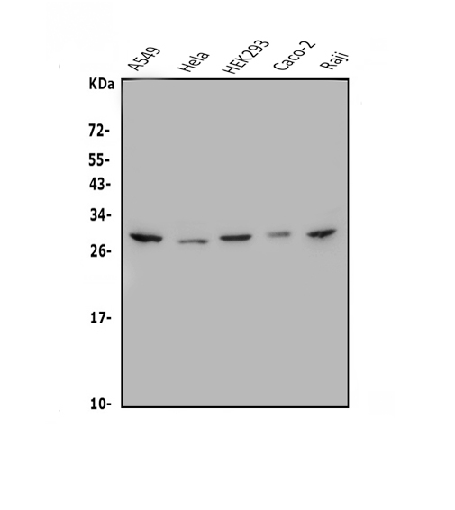 MESP1 Antibodies | AntibodyResource.com
