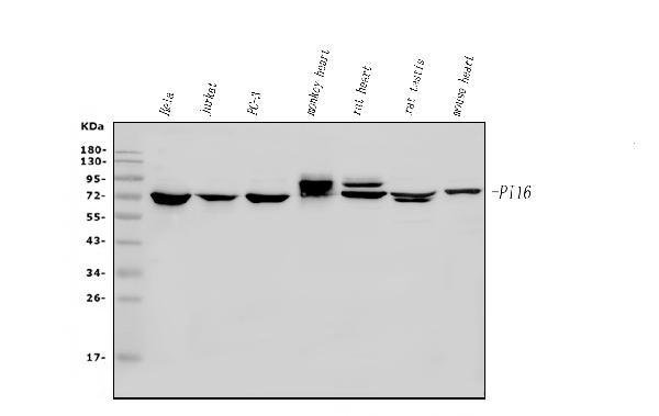 Anti-PI-16/PI16 Antibody Picoband™| Bosterbio