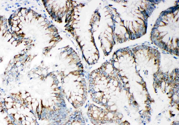 MMP14/Matrix metalloproteinase-14 Antibody