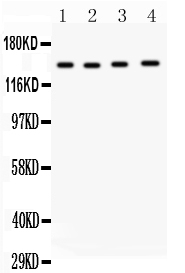 MMP14/Matrix metalloproteinase-14 Antibody