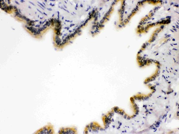 Anti-RAGE/AGER Antibody Picoband™ (PB9469) | Bosterbio