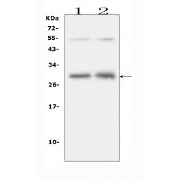 Anti-IL-31 Antibody Picoband™ | Bosterbio