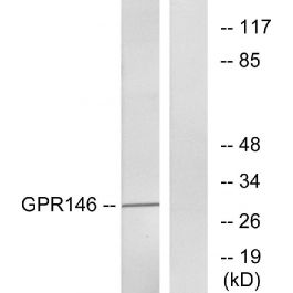 Anti-GPR146 Antibody A30811
