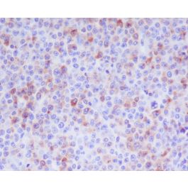 Anti-Granzyme B Monoclonal Antibody | IHC Validated | Bosterbio