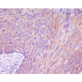 DSG1/Desmoglein 1 Rabbit Monoclonal Antibody