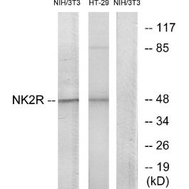 Anti-Substance-K receptor/NK2R Antibody (A30847) | Bosterbio