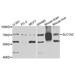 Anti-SLC1A2 Antibody