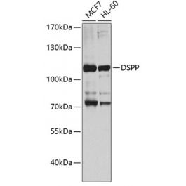 Dentin sialophosphoprotein DSPP Antibody A01740