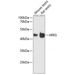 Anti-Amphiregulin AREG Antibody | Boster