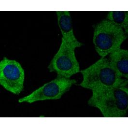 Ferritin Heavy Chain FTH1 Antibody A02401-2