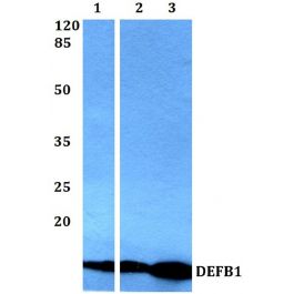 Anti-Beta-defensin 1 DEFB1 Antibody