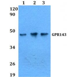 G-protein coupled receptor 143 GPR143 Antibody