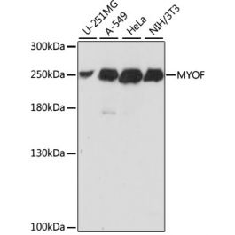 Anti-Myoferlin MYOF Antibody