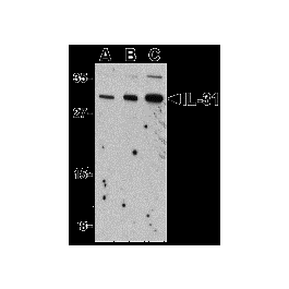 Anti-IL-31 Antibody