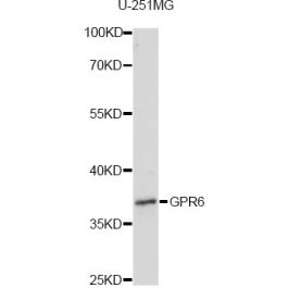 G-protein coupled receptor 6 GPR6 Antibody A09376