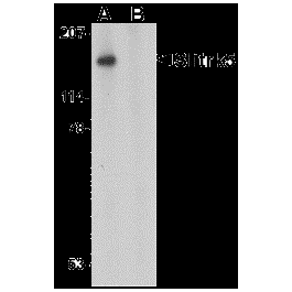 SLIT and NTRK-like protein 5 Slitrk5 Antibody