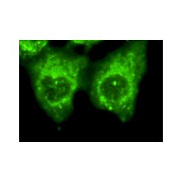 Arrestin-beta-2 ARRB2 Monoclonal Antibody