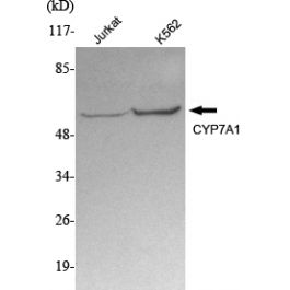 Anti-CYP7A1 Monoclonal Antibody