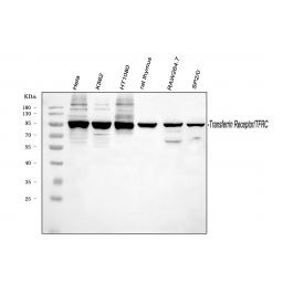 Transferrin Receptor/TFRC Antibody