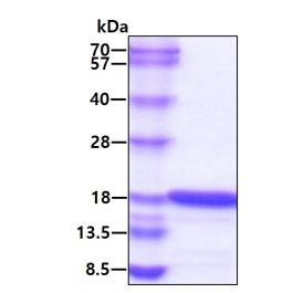 Human Ferritin/FTH1 Recombinant Protein