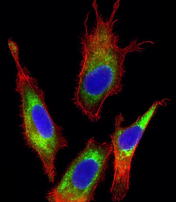 Anti-Transferrin Antibody | Boster