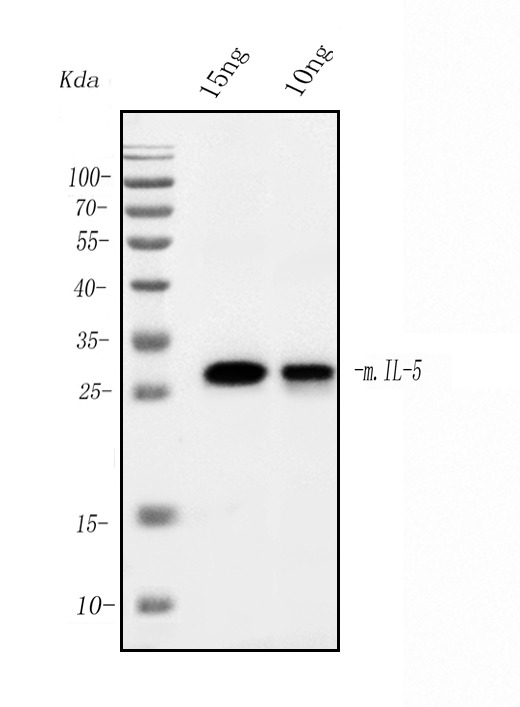 Anti- IL-5 Monoclonal Antibody| Bosterbio