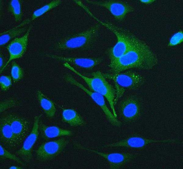Cytokeratin 18 KRT18 Antibody(monoclonal, 7I6)