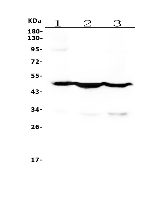 Cytokeratin 18 KRT18 Antibody(monoclonal, 7I6)