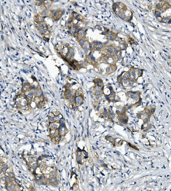 alpha 1 Catenin/CTNNA1 Antibody