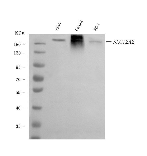 Anti-NKCC1/SLC12A2 Antibody Picoband™ (monoclonal, 6G7D2)