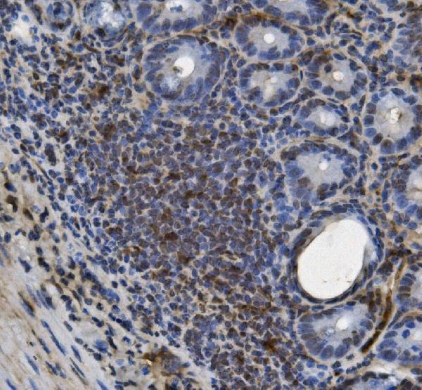 U2AF65/U2AF2 Antibody