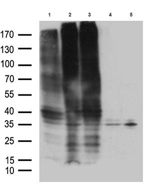 Anti-GPR17 Antibody